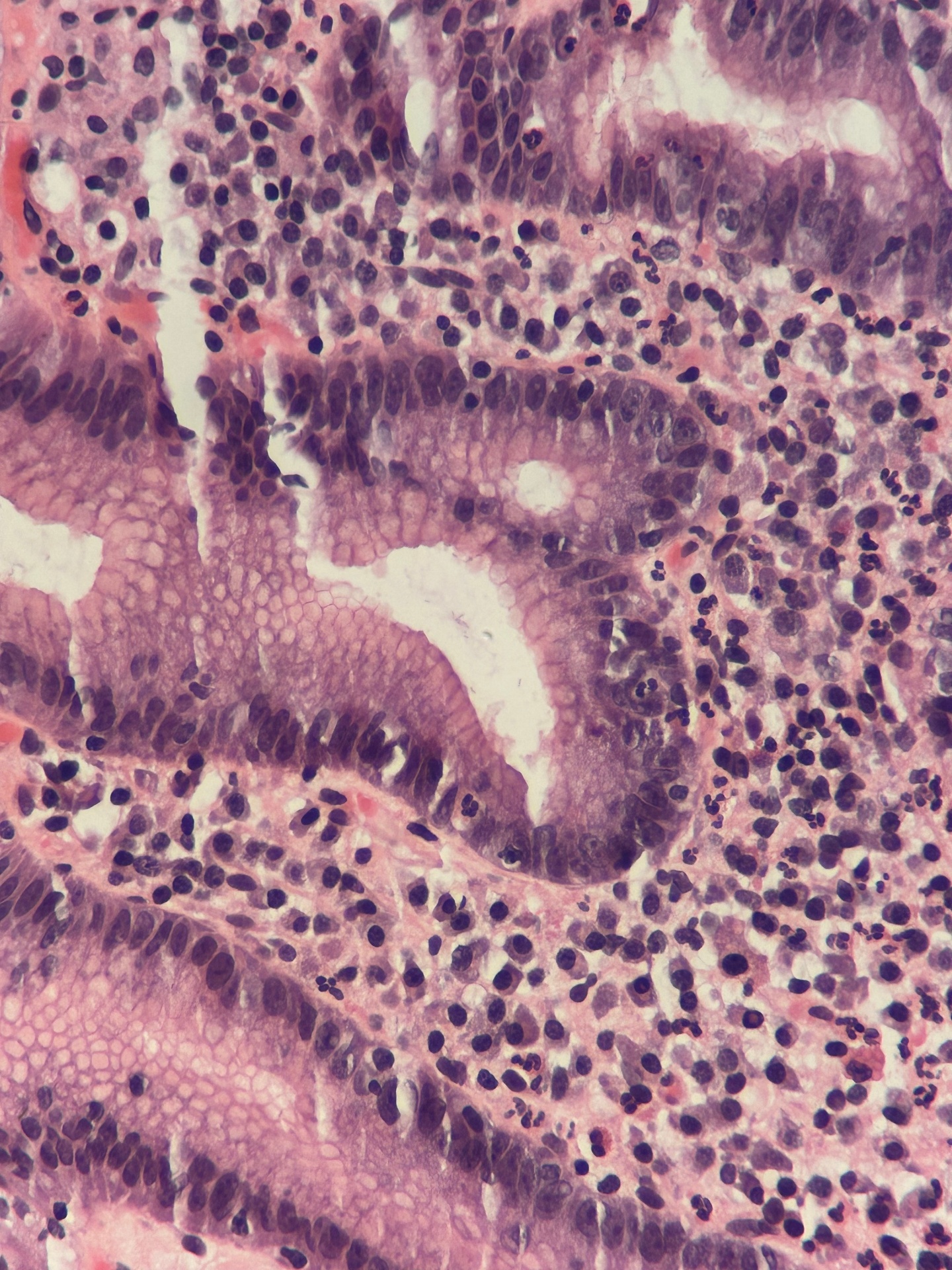 RainPath - AI for Pathologists