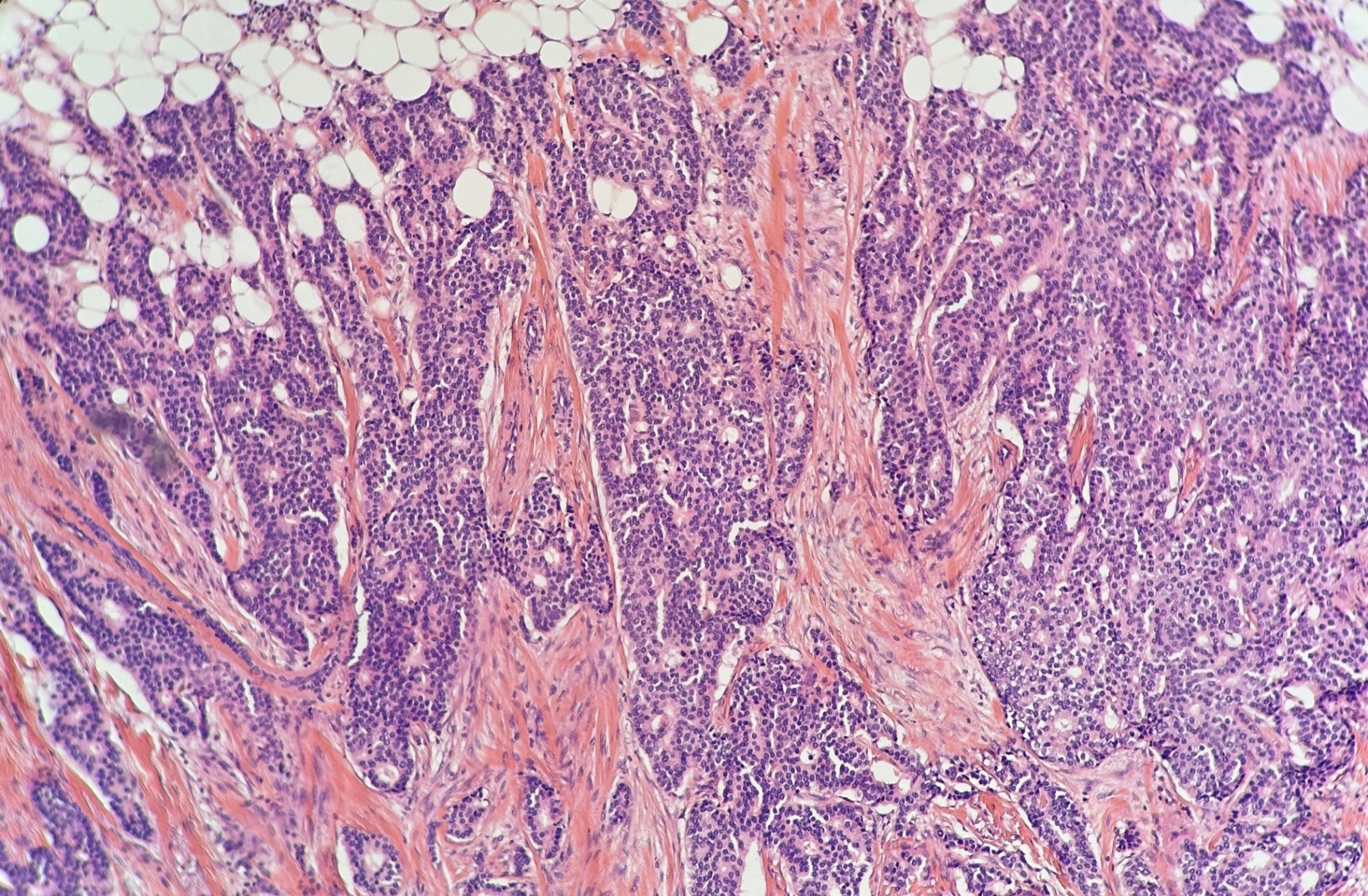 RainPath - AI for Pathologists