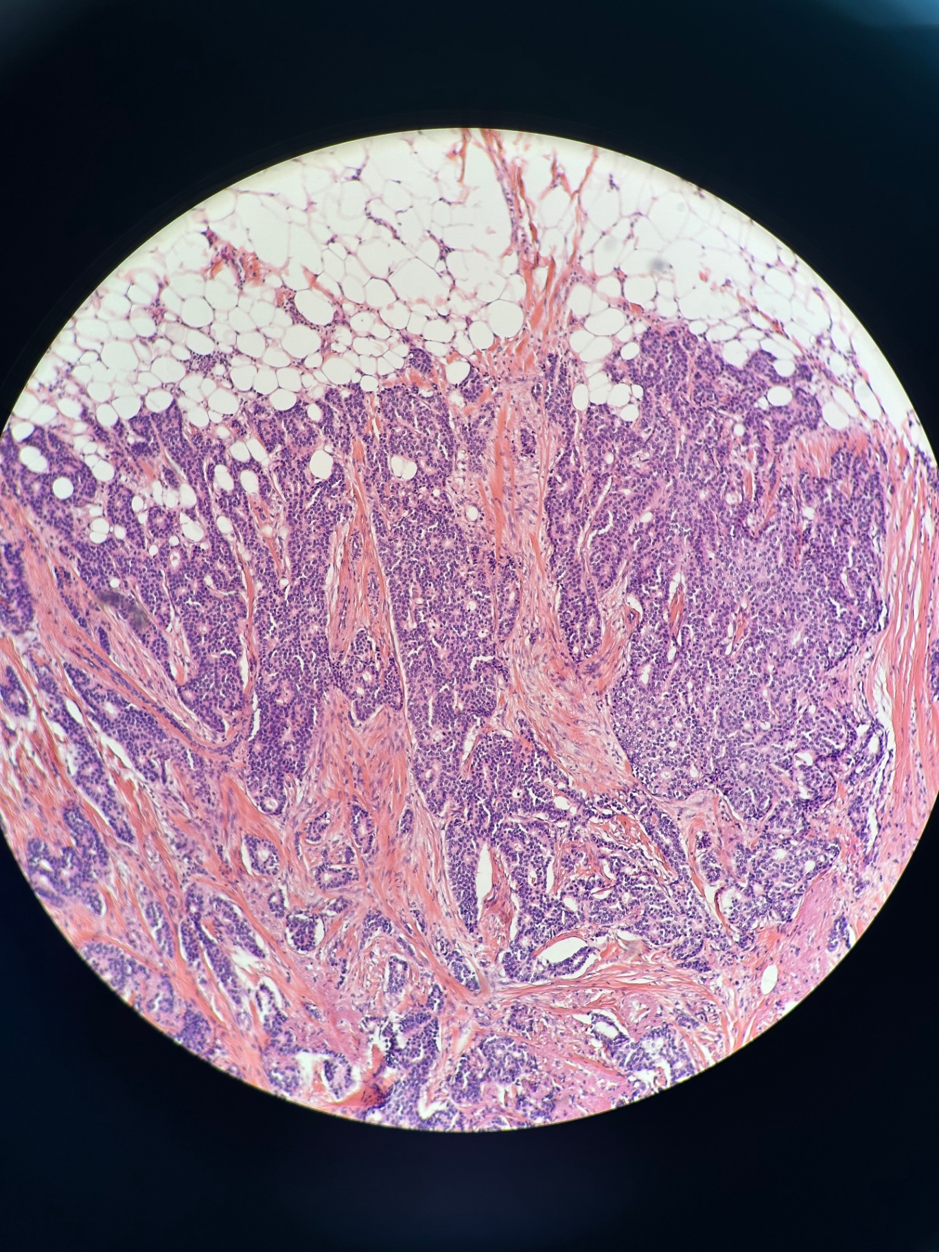RainPath - AI for Pathologists